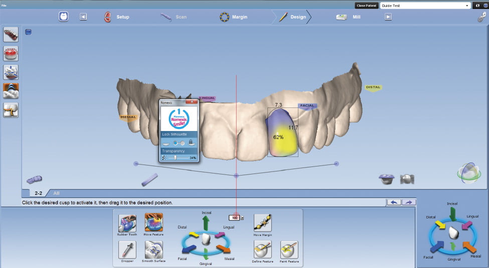 Implantologia 3D z firmą Planmeca - Unity stomatologiczne premium, CBCT, RVG, CADCAM ...